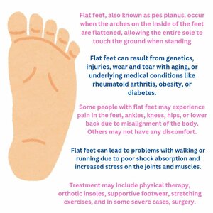 Understanding Flat Feet (Pes Planus): Causes, Symptoms, and Treatment ...